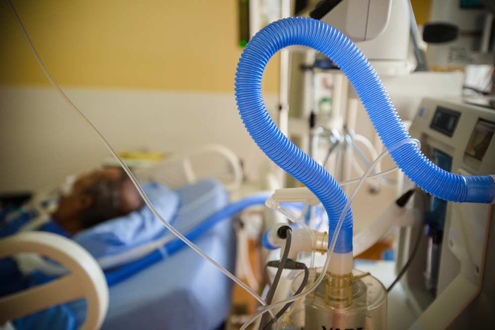 Severity Based Critical Illness RGA severity-based-critical-illness-rga